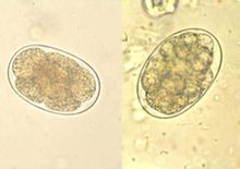 Ankylostome - Pages [3] - Mondiale connaissance encyclopédique